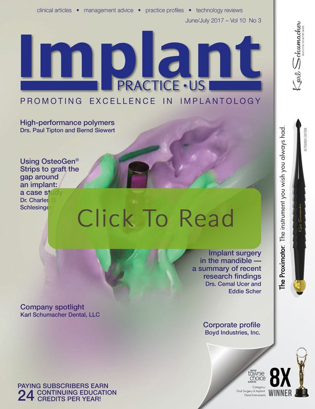 Introducing ATLANTIS Conus concept by DENTSPLY Implants Implant Practice US